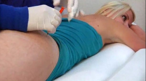 Bum Injection Injectionnurse
