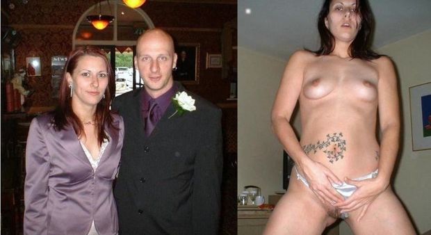 Theskilo Amateur Before And After Pin 17302027
