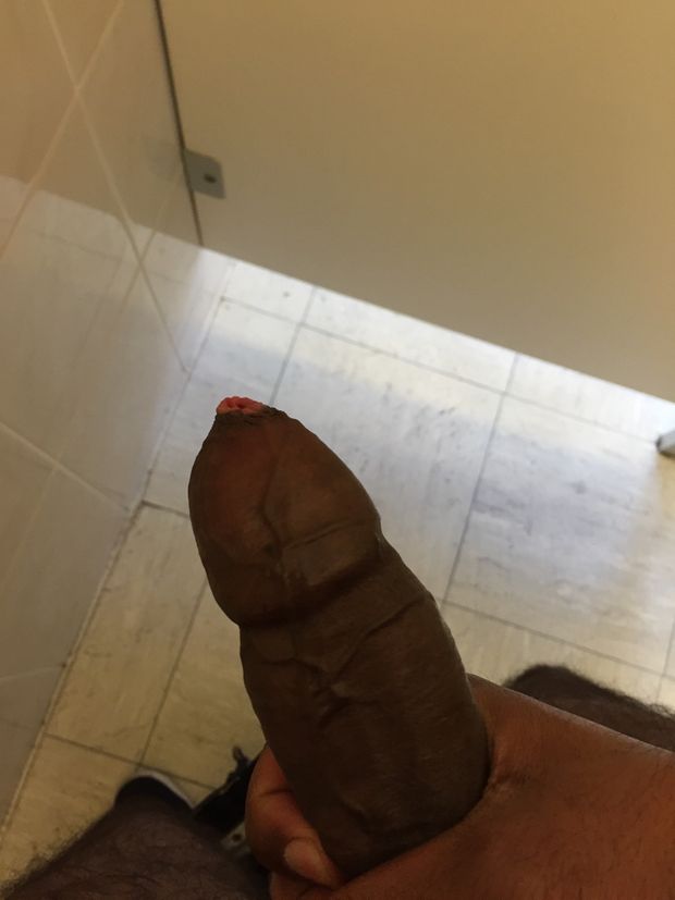 Tight Foreskin Magahp