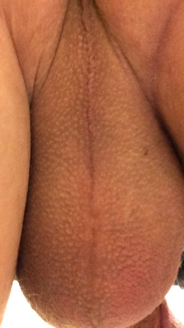 Under Scrotum Stevermilk