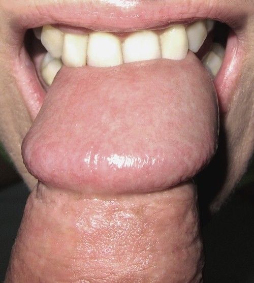 Head Bite Luckysting
