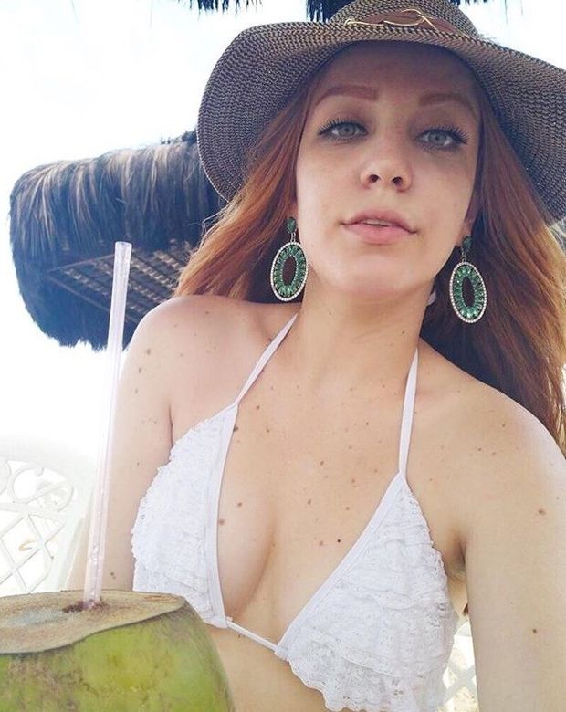 Freckles Redhead Fomoco
