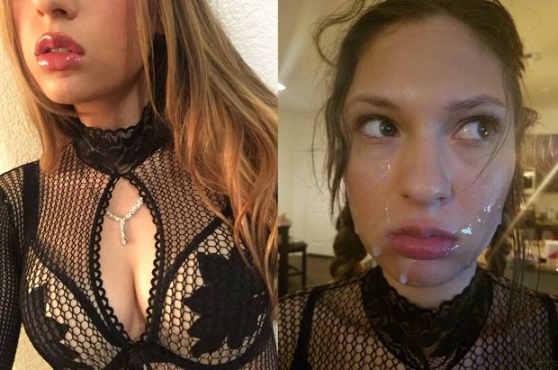 Before After Chadstem