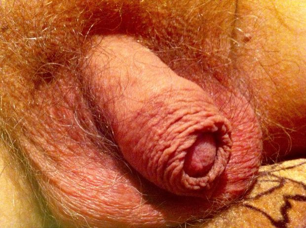 My Dick Runaniru