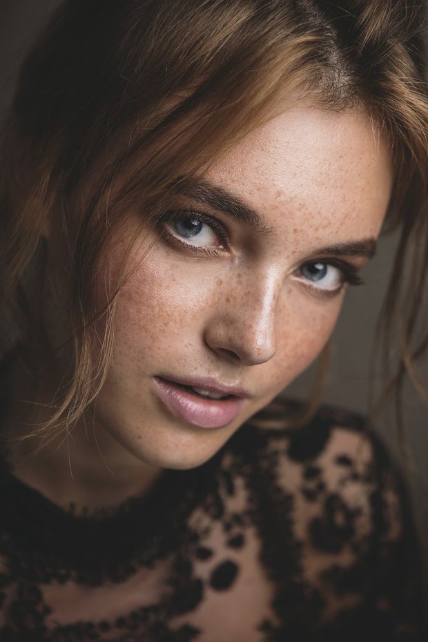 Ojos Con Pecas Pheddy