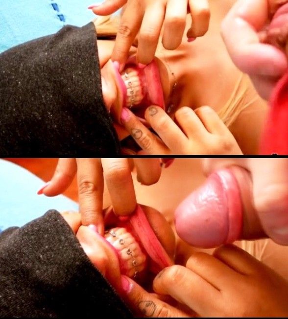 Brace Face Sophie Sucking Dick Sadielexxxington