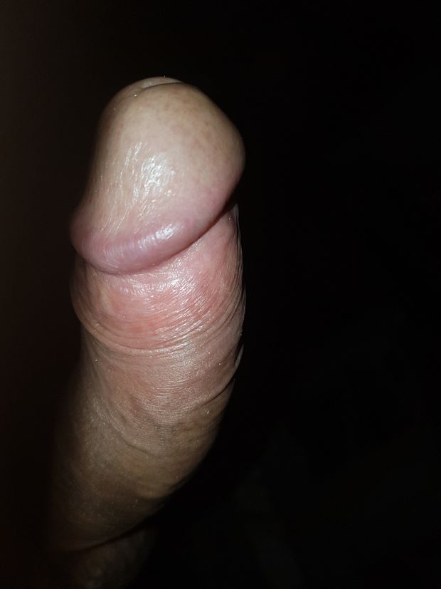 My Misterious Dick Runaniru
