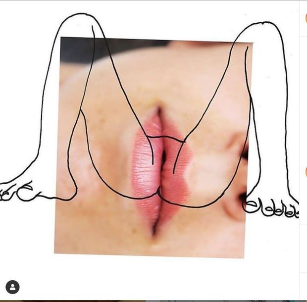 Overlay Budcrutch