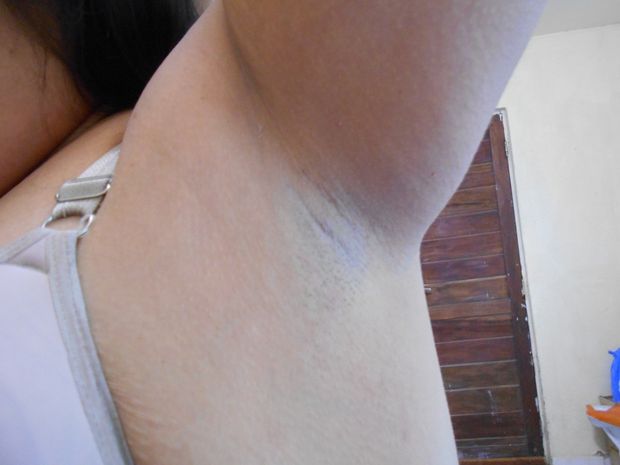 Armpit Female Brazilrndick