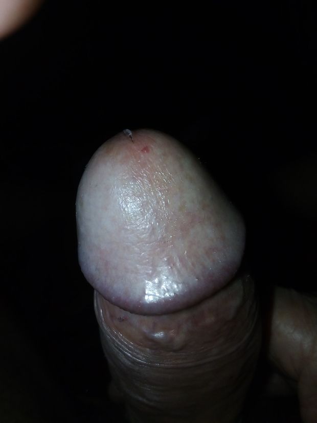 My Glans And Precum Engorged