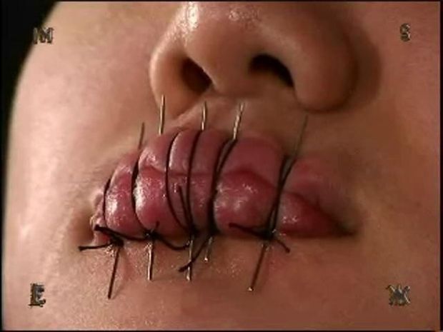 Fake Sutures Superdom