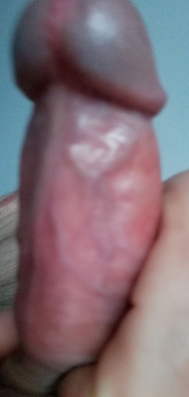 Me Dick Pitsi