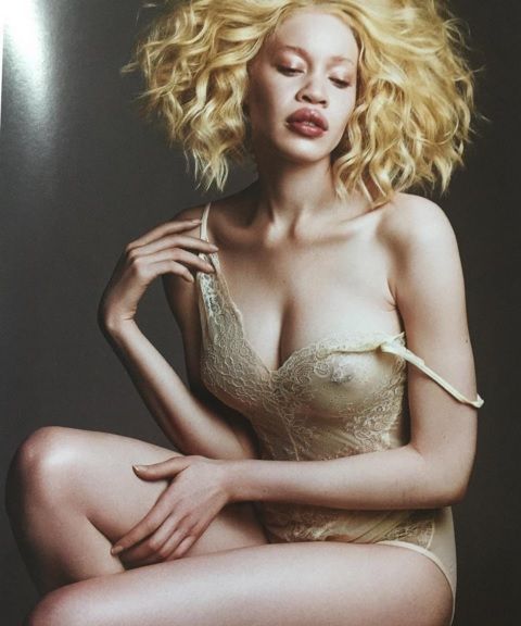 Albino Ebony Beauty Diandre Forrest Secksitaim