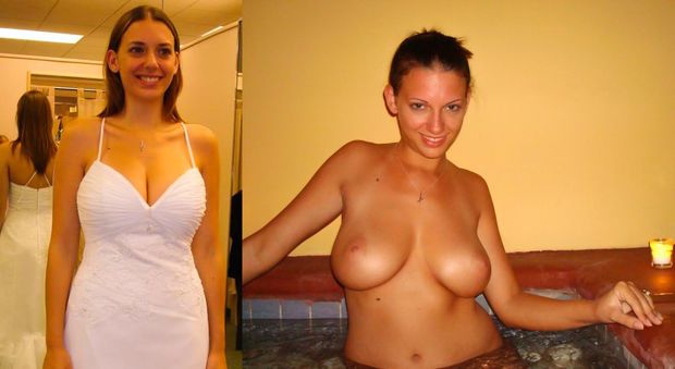 Before And After Titsnass