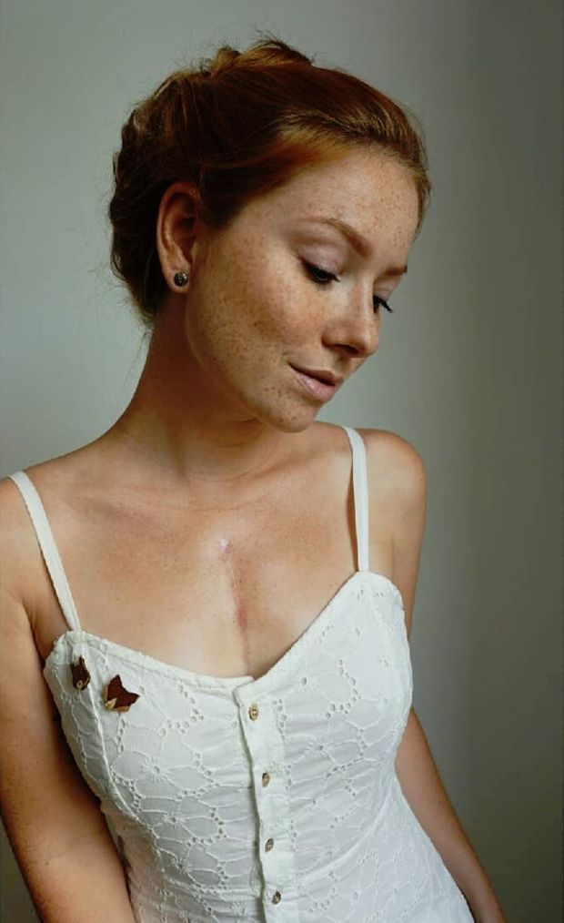 Duinerua Redlust Redheads Pin 60275897