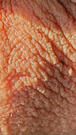 Scrotum Pics