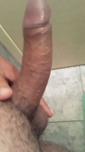 Artecadias Venosas Grandes