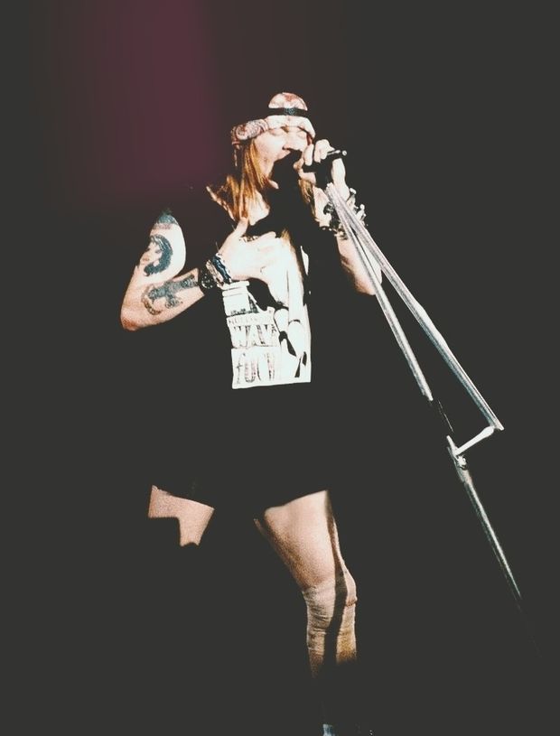 Axl Rose Photo Xurgatzen
