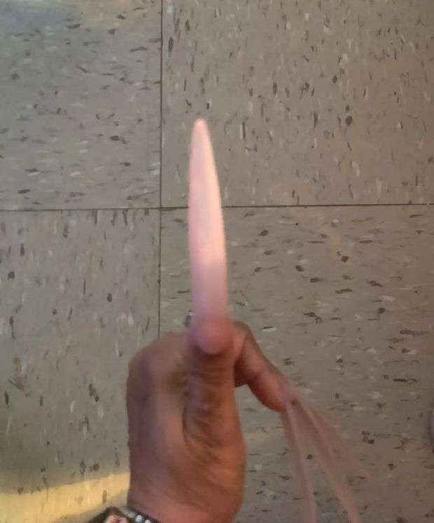 Dont Scratch Too Much Icarusnewport