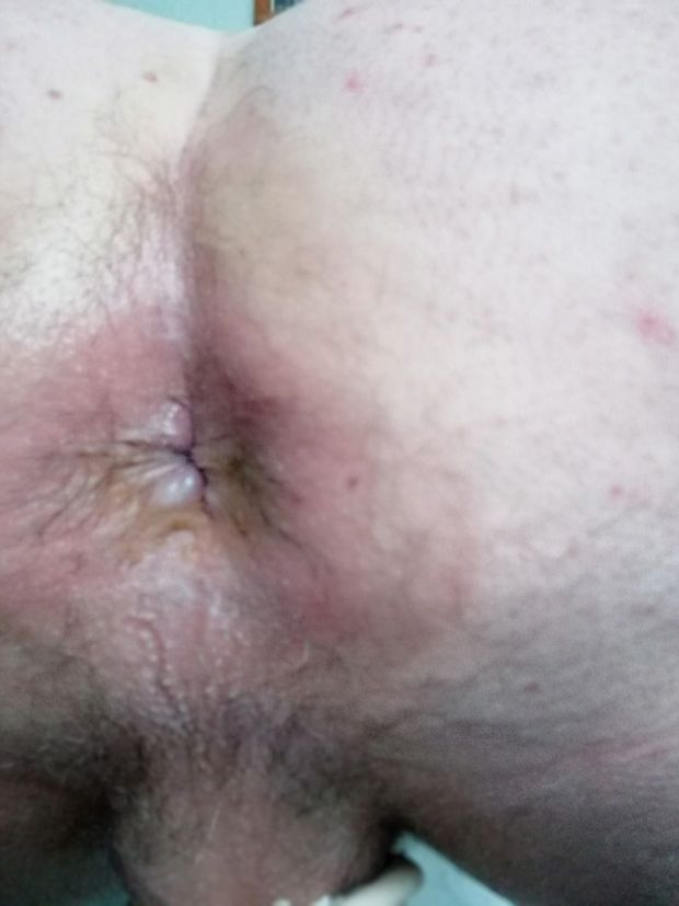 Me Ass Pitsi