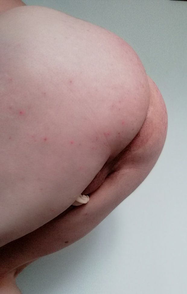 Me Ass Pitsi