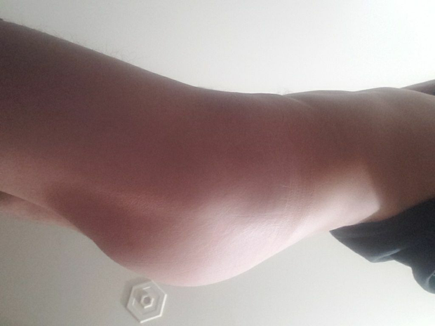 Im Not Too Skinny Am I Buttfeet