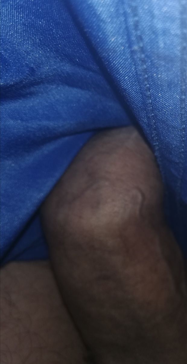 Me Dick Pitsi