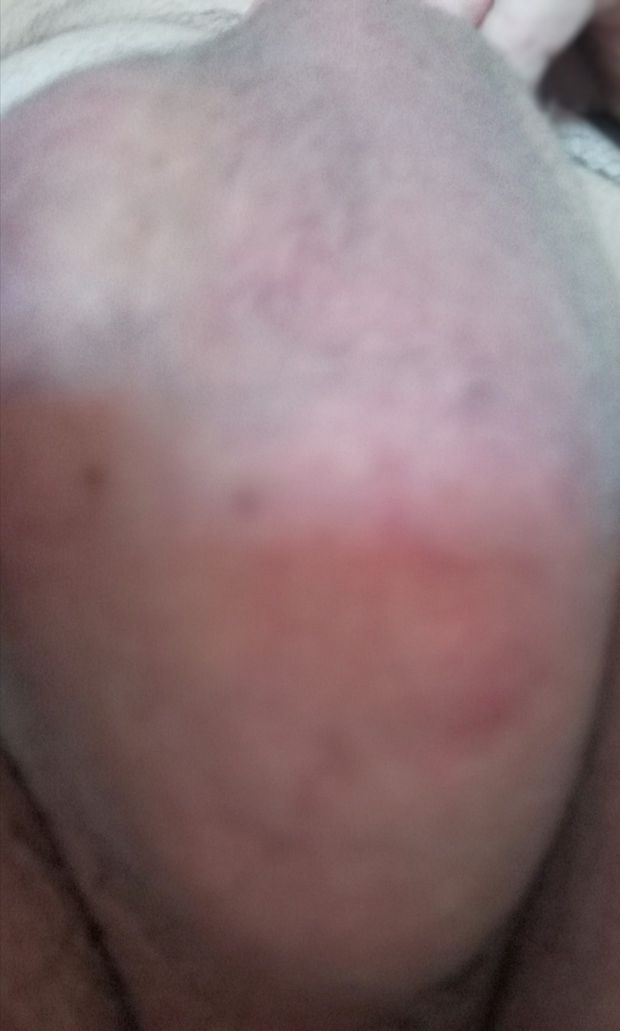 Me Balls Pitsi