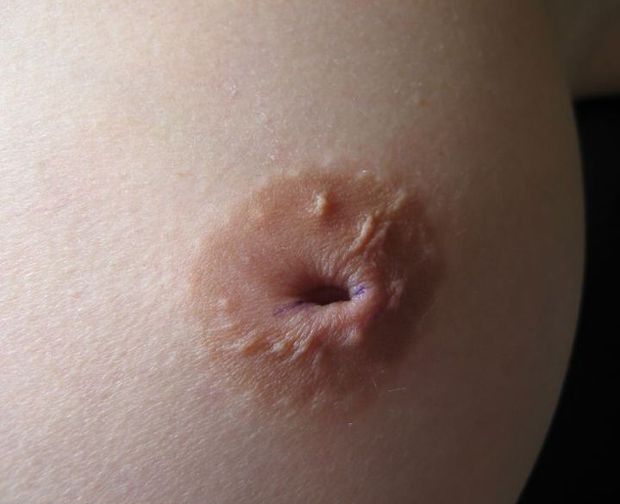 Inverted Nipple Kyblue333