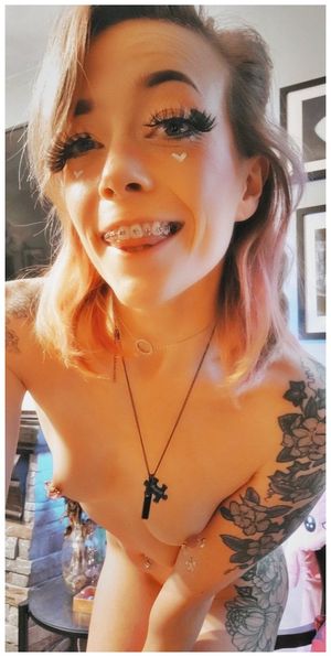 Braces Fetish Pics