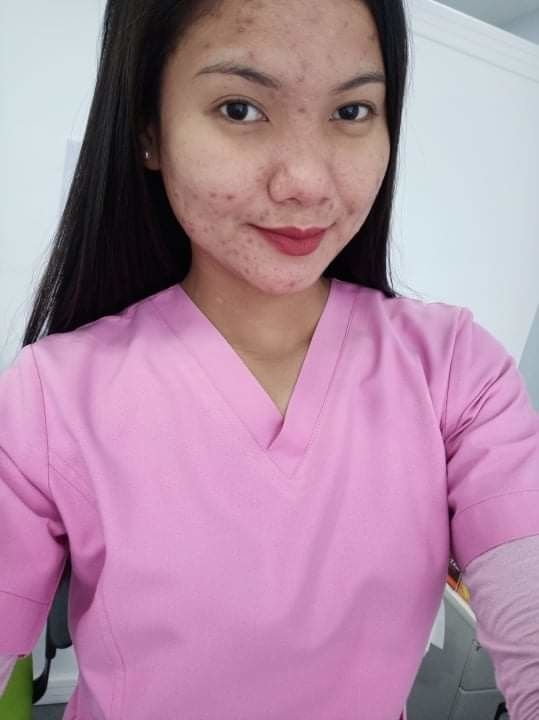 Me In My Laser Tech Uniform Ailynmacaspac