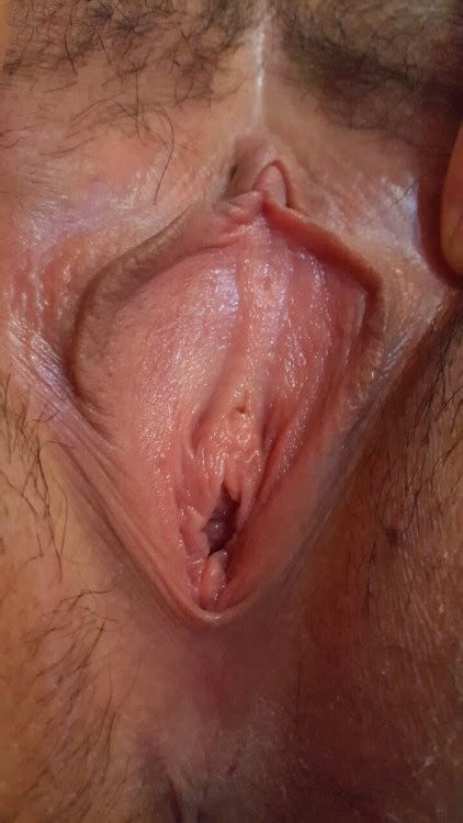 Zururu Amateur Pin 66267779