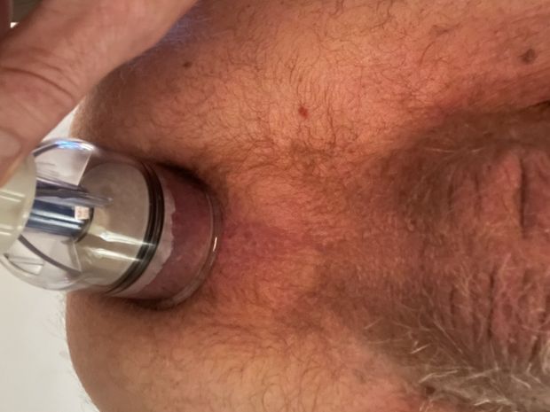 Bimodal Ass Vac Bimodal