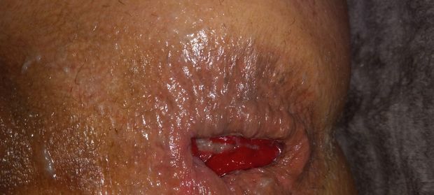 Start Of Rosebud 5inches