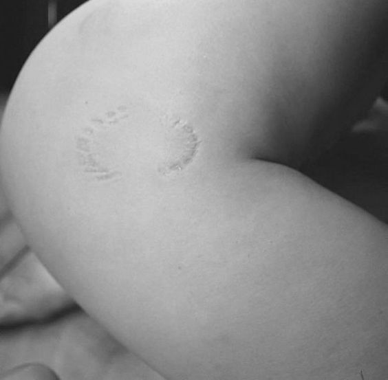 Does A Bite Mark Indicate Ownership Aslan13
