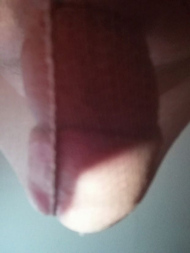 Me Dick Pitsi